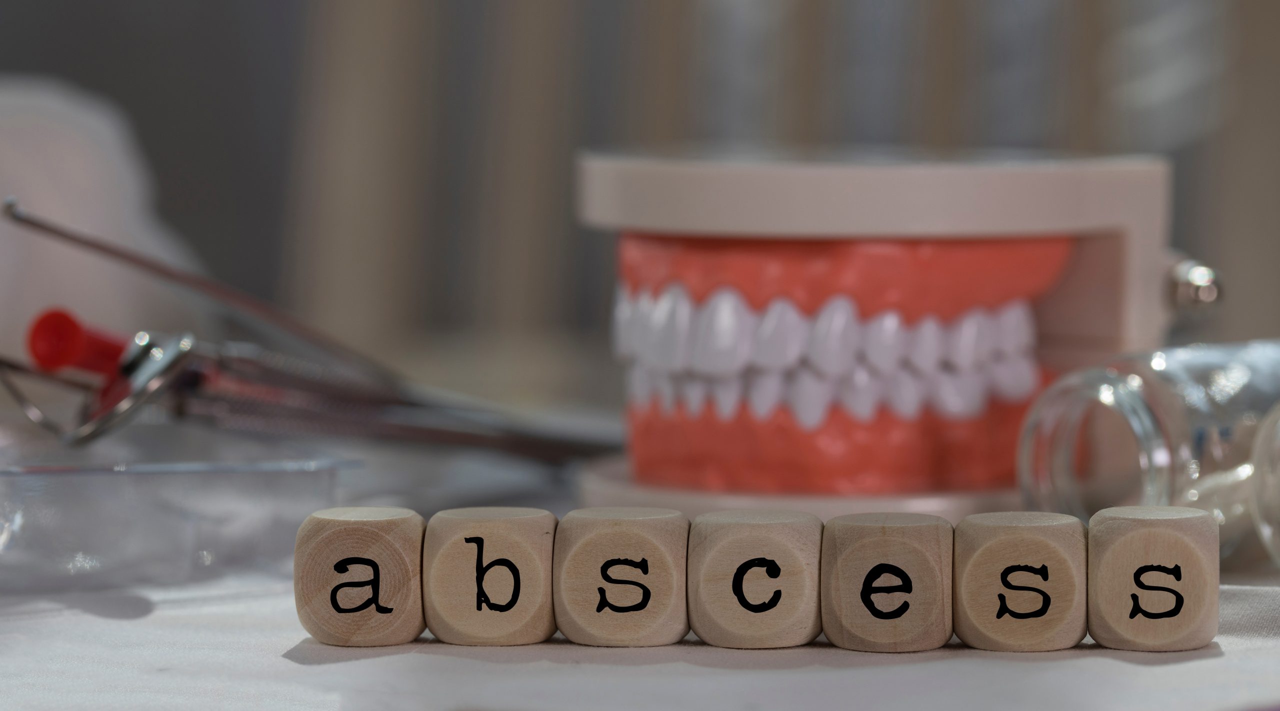 Understanding an Abscessed Tooth: Causes, Symptoms, and Treatment ...
